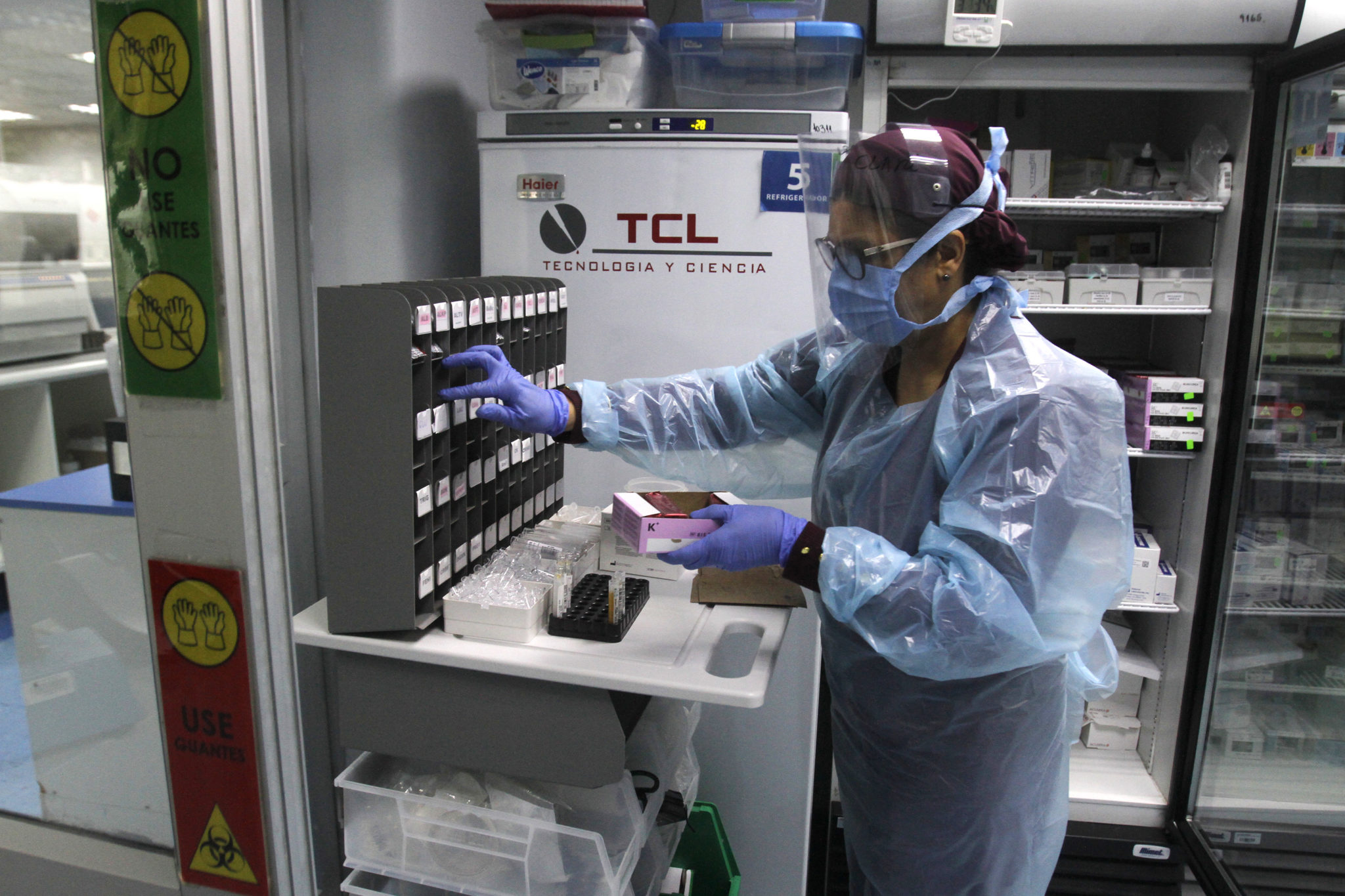 Laboratorio Hospital clinico de la Universidad de Chile – Calev ...
